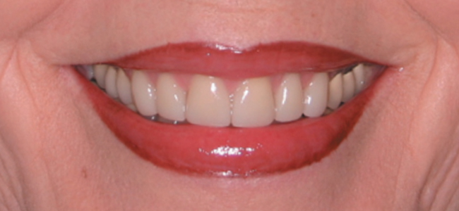 3a - Katsur Dental & Orthodontics